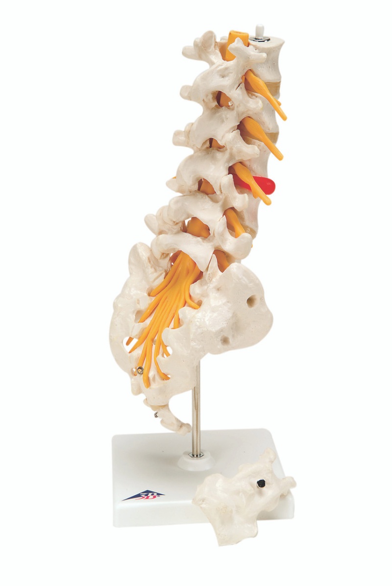 Lumbosacral Spinal Column With Herniated Disc, 3B Smart Anatomy